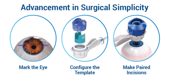 Introducing… – MicroSurgical Technology